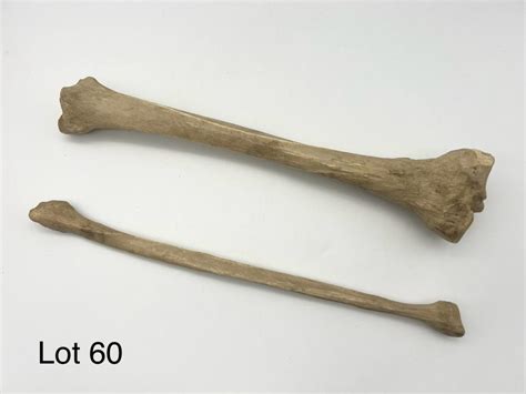 Sold At Auction Antique Authentic Human Bone Tibia And Fibula Set