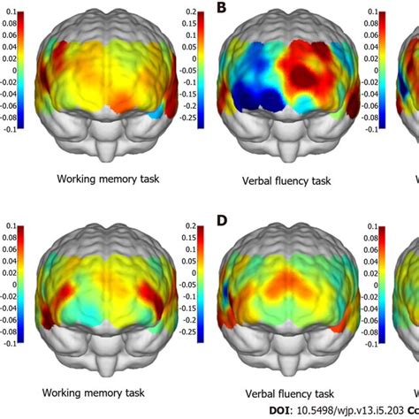 Comparison Of Functional Near Infrared Spectroscopy Patterns And Task Download Scientific