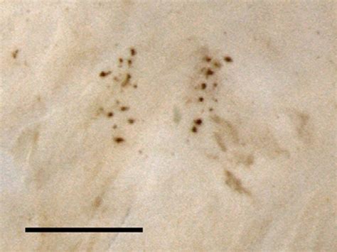 The V Shaped Scarring Pattern Caused By The Jaw Like Structures In The Download Scientific