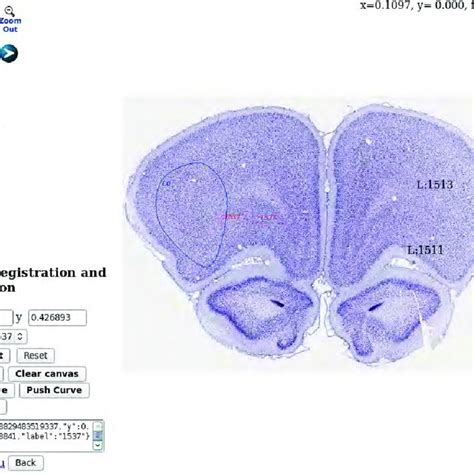 Spatial Annotation And Atlas Registration Three Types Of Atlas Download Scientific Diagram