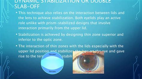 Soft Toric Contact Lens Pptx