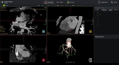 Cvi42 Overview Circle Cardiovascular Imaging