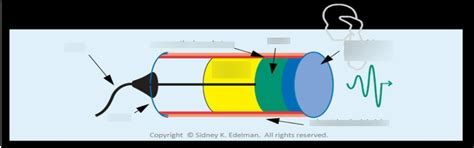 Basic Transducer Construction Diagram Quizlet
