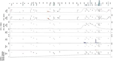 Comment On The Article “good Urodynamic Practices Uroflowmetry Filling Cystometry And