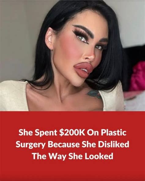 Plastic Surgery Addict Spends 200k On Plastic Surgery 24 7
