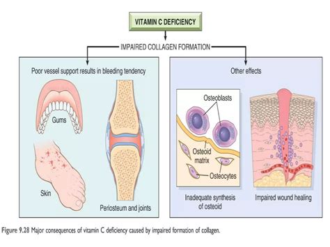 Nutritional Diseases Pptx