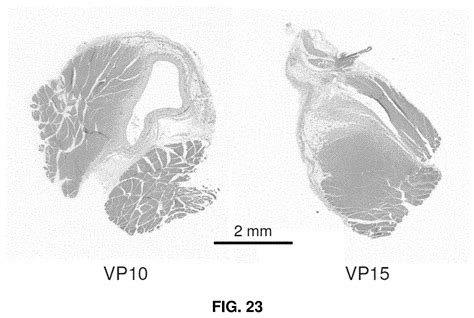 Biodegradable Thermally Responsive Injectable Hydrogel For Treatment