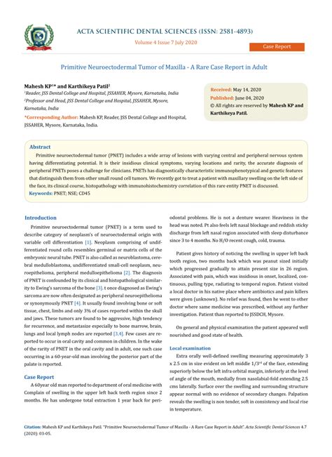 Pdf Acta Scientific Dental Sciences Issn 2581 4893 Primitive Neuroectodermal Tumor Of