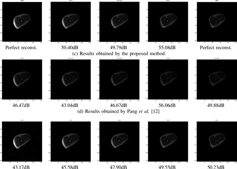 Figure 2 From Compressed Sensing Mri Using Sparsity Induced From Adjacent Slice Similarity