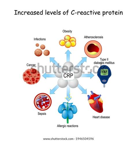 20 C Reactive Protein Test Stock Vectors And Vector Art Shutterstock