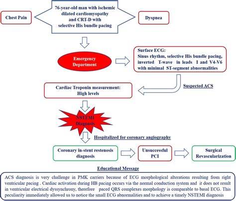 Diagram Representing The Decision Diagnosis Strategy CRT D Cardiac Download Scientific