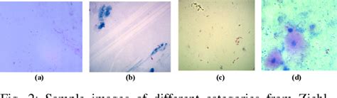 Figure From Implementation Of A Modified U Net For Medical Image Segmentation On Edge Devices