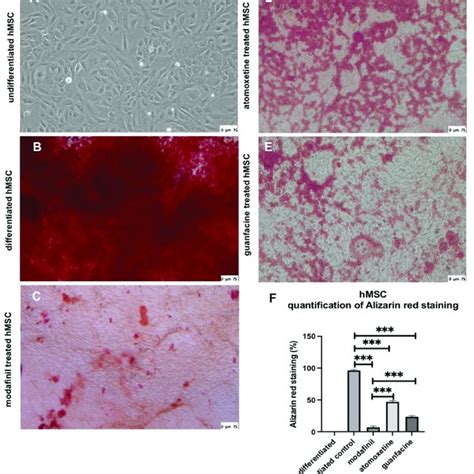 Osteogenic Differentiation Medium Download Scientific Diagram