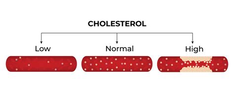 Cholesterol Level Science Design Illustration Diagram Vector Art At Vecteezy