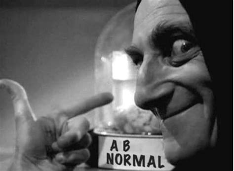 Young Frankenstein Igor Brain