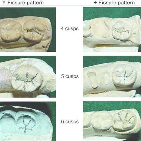 Pdf Occlusal Morphology Of Mandibular Second Molars In Iranian Adolescents