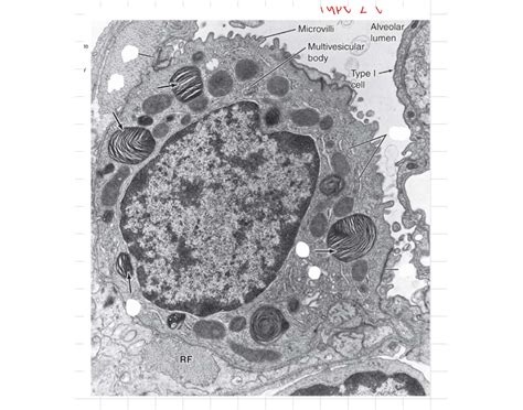Type 2 Alveolar Cell Quiz