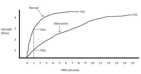 Top 5 Spirometry Tips For Copd Diagnosis And Management Respiratory Therapy