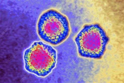 Adenovirus Tem Stock Image C0438401 Science Photo Library