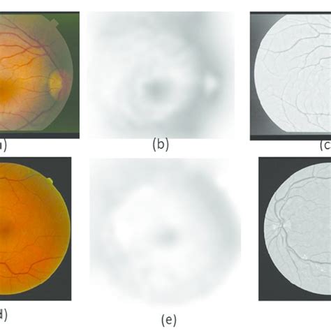 Bias Correction Results A Stare Image With Intensity Inhomogeneity Download Scientific