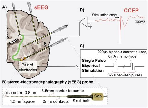 Illustration Of Cortico Cortical Evoked Potentials Cceps Experimental Download Scientific