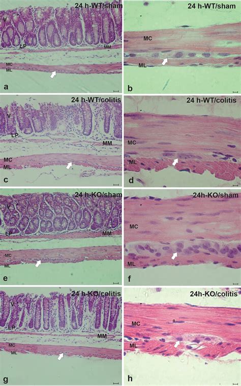Photomicrographs Showing Hande Stained Sections Of The Myenteric Plexus