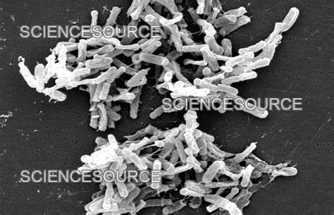 Clostridium Difficile Bacteria Under Stock Image Science Source Images