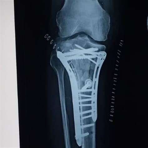 X Ray Comparison Rxrayporn