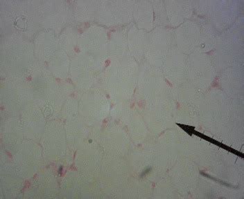 Tissues Pictures From Microscope Flashcards Quizlet