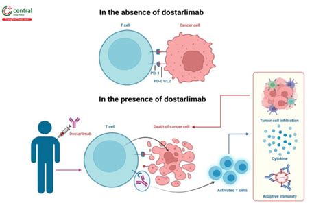Thuốc Dostarlimab điều Trị Ung Thư Nội Mạc Tử Cung