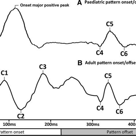 Pattern Onset And Offset Visual Evoked Potentials In The Diagnosis Of Hemianopic Field Defects