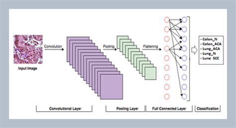 Diagnosis Of Lung And Colon Cancer Based On Clinical Pathology Images