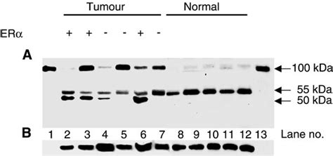 Analysis Of Fibulin 1 Protein Expression In Representative Breast Download Scientific Diagram