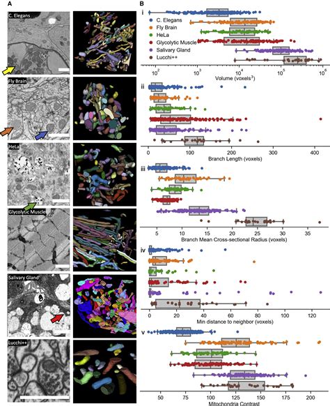 Instance Segmentation Of Mitochondria In Electron Microscopy Images With A Generalist Deep
