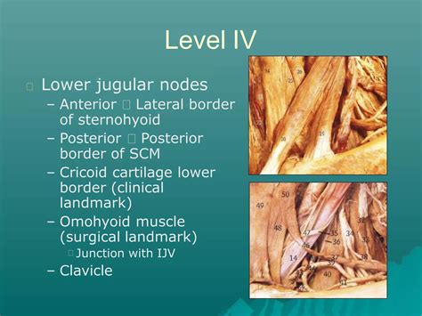 Neck Dissection Pptx Ear Nose And Throat Conditions Diseases And