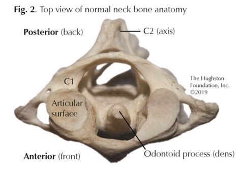 Axis Bone Diagram
