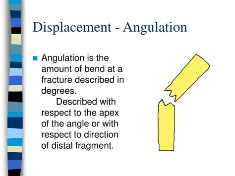 Ppt Fracture Description And Classification Powerpoint Presentation Id 1458947