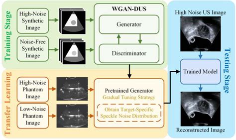 Figure 1 From Ultrasound Speckle Reduction Using Wavelet Based Generative Adversarial Network