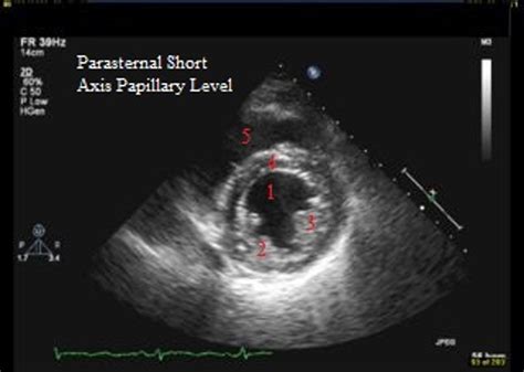 Psax Papillary Labeling Diagram Quizlet
