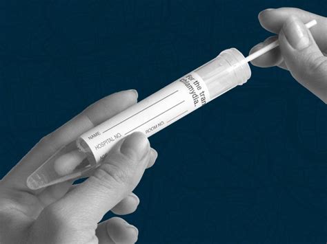 Where To Get Tested For Stds Testing Information And More