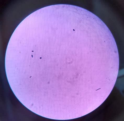 Solved Experiment Cell Counting And Viabilityplease Count