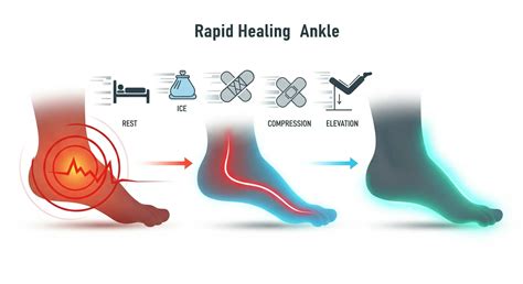 How To Heal A Sprained Ankle Overnight Before It Gets Worse