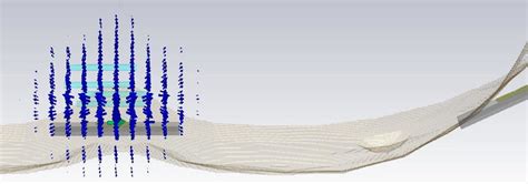 Reflections From The Sternotomy Wires Furthermore The Power Flow Download Scientific Diagram