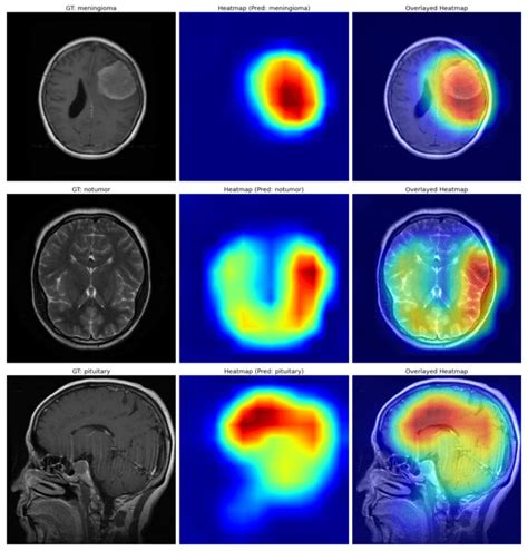 Gradcam Enhancing Neural Network Interpretability
