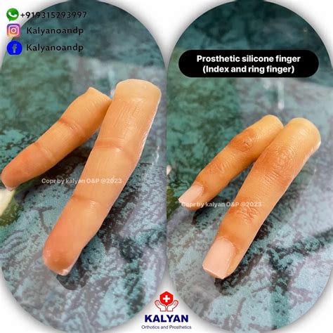 Silicone Prosthetic Finger At Best Price In New Delhi Id 2851032639133