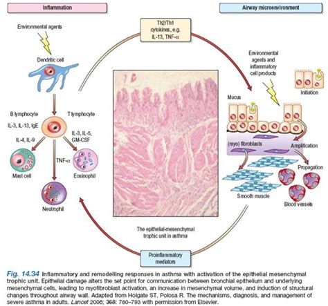 Pathophysiology Of Asthma