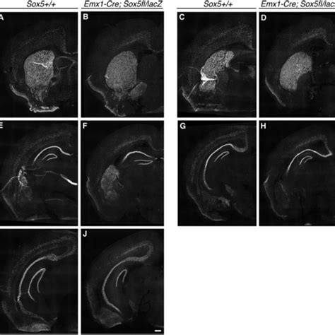 Fig S5 Subcerebral Neurons Labeled By High Level Ctip2 Expression Download Scientific