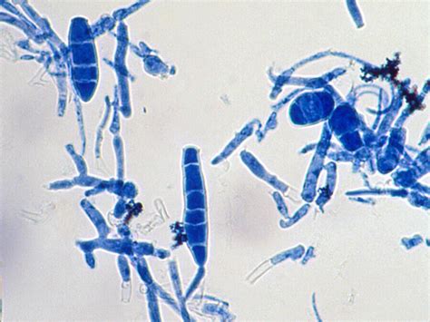 Unknown 51 Mycology University Of Adelaide