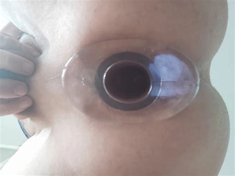 Rascasse Pics XHamster