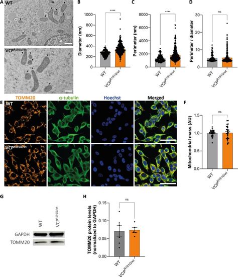 A Pathogenic Mutation In The Als Ftd Gene Vcp Induces Mitochondrial Hypermetabolism By
